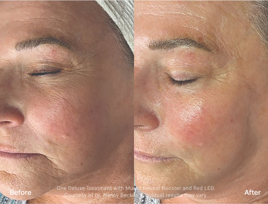 Hydrafacial Solutions | Treatments for All Skin Concerns – Hydrafacial ...